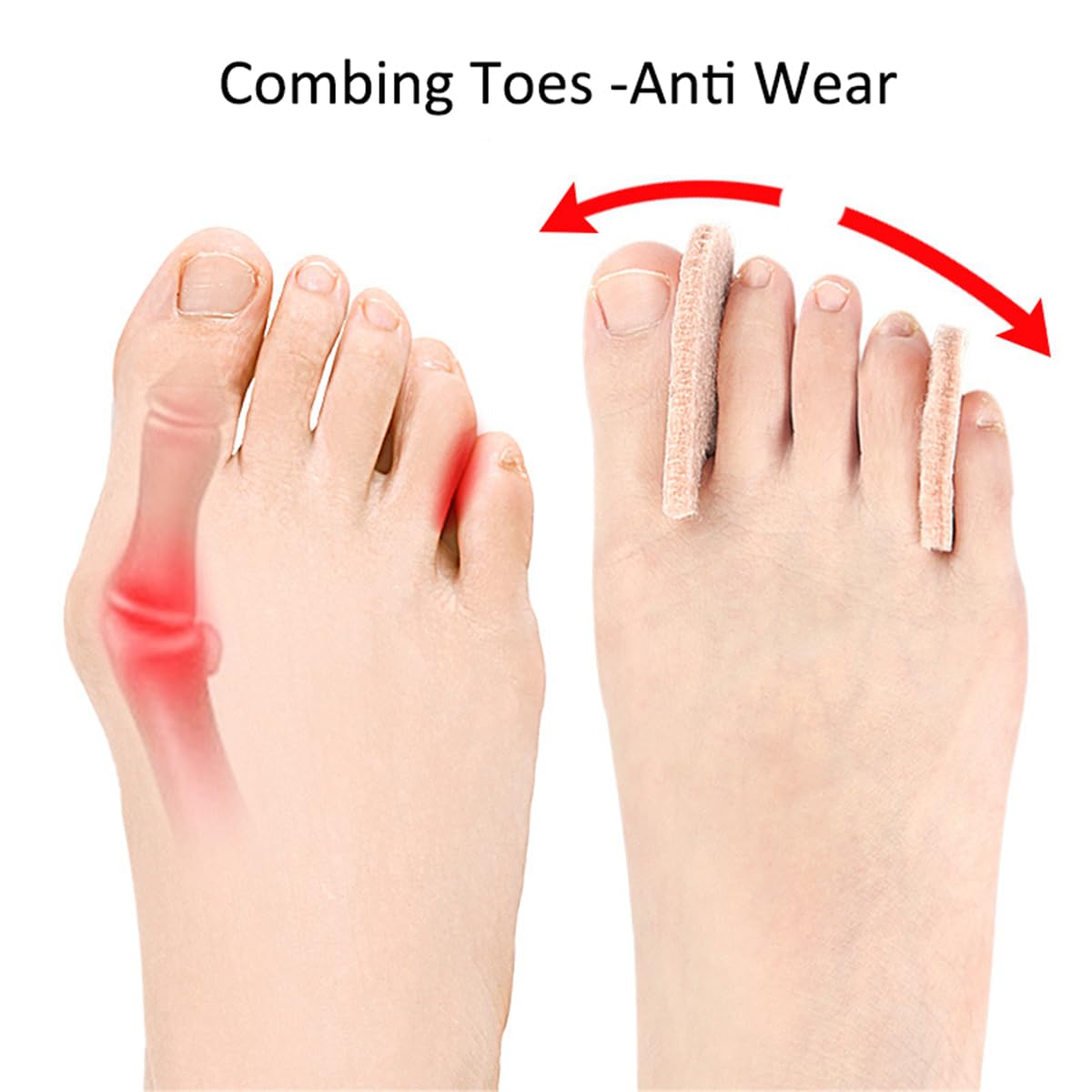 Snapklik.com : Felt Toe Separators, 20 PCS Bunion Corrector Pads For ...