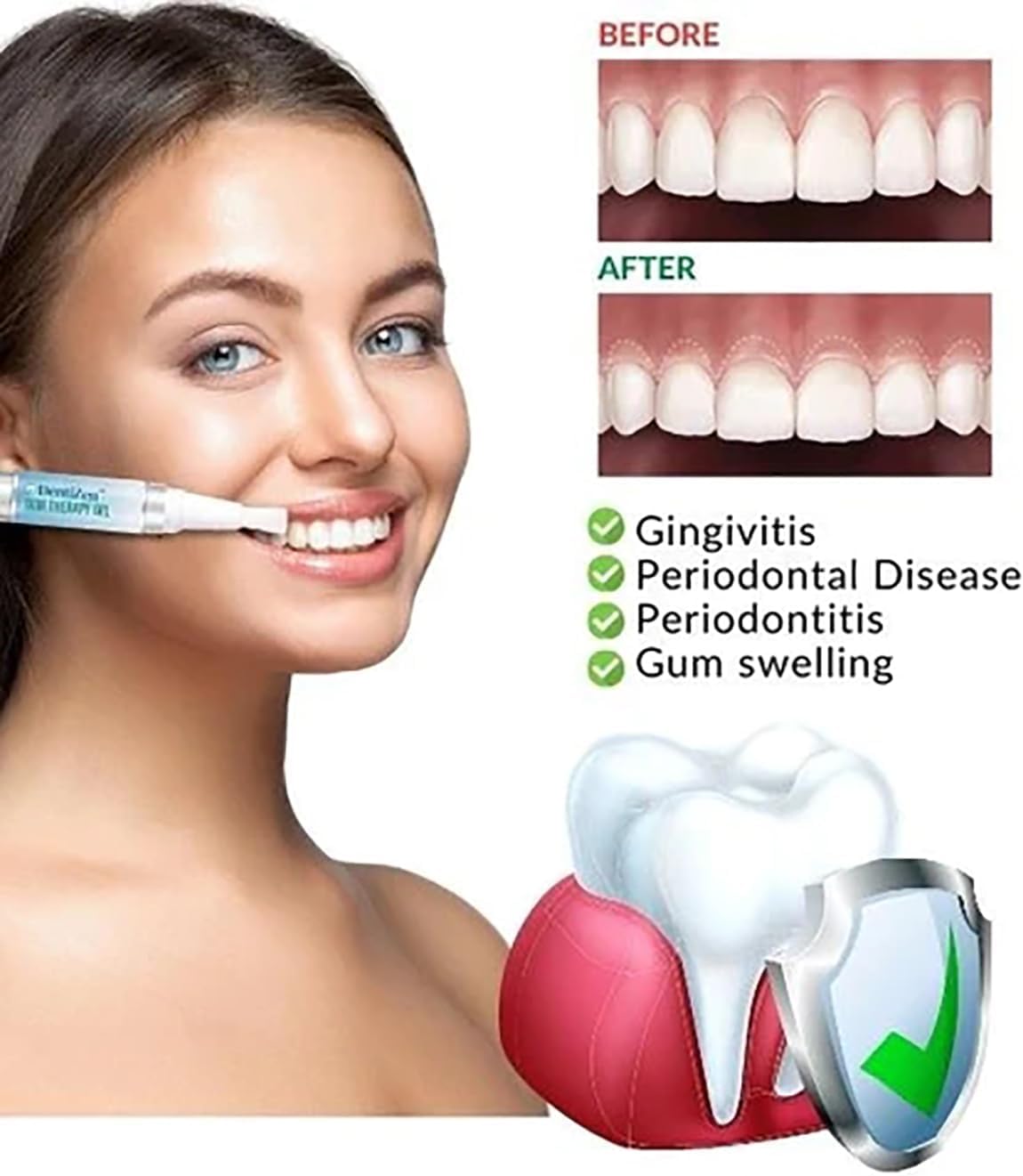 Gingivitis Treatment Gum Disease Treatment And Periodontal Care