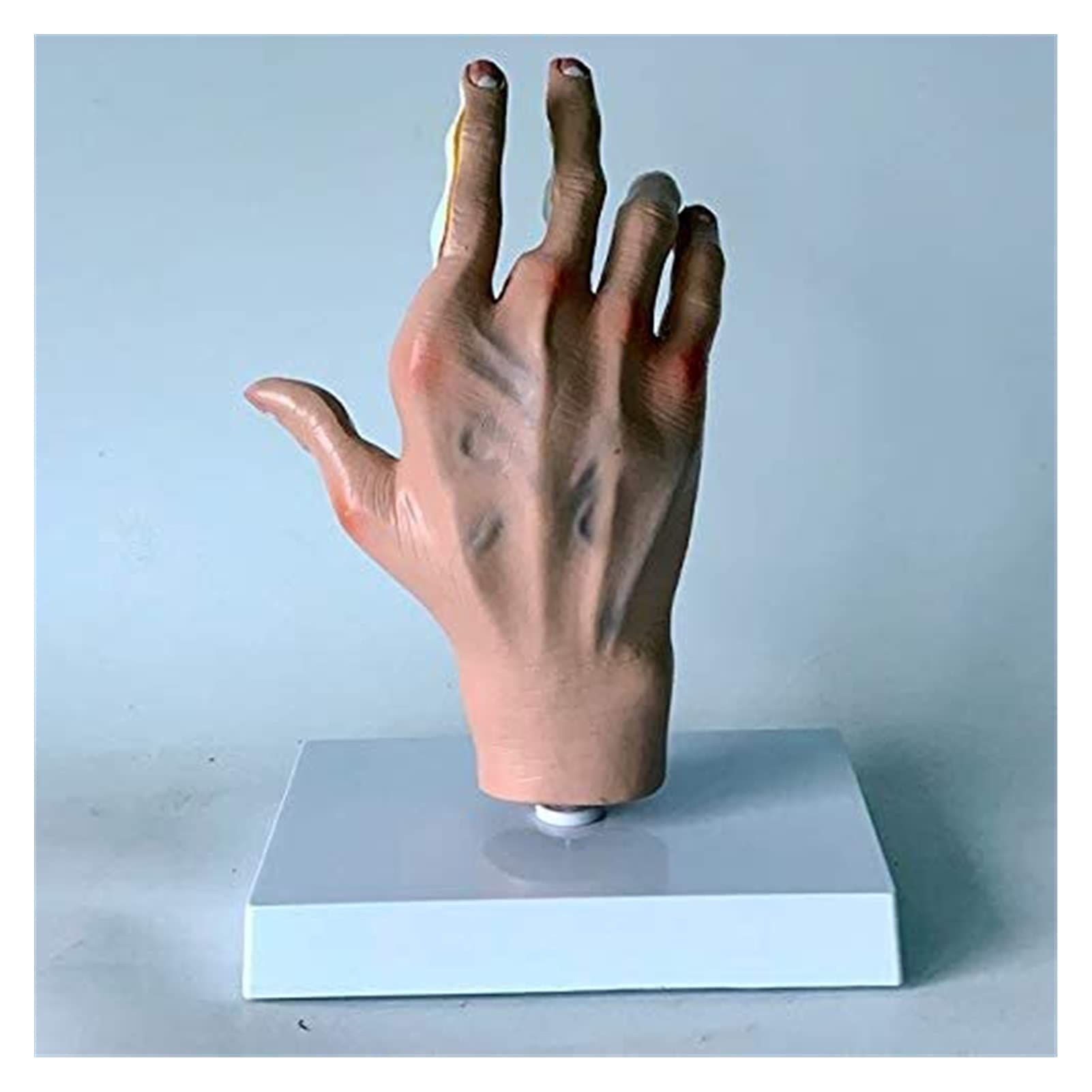 Buy Palm Anatomy Models Hand Anatomy Model Anatomy Diseased Palm Tendon ...