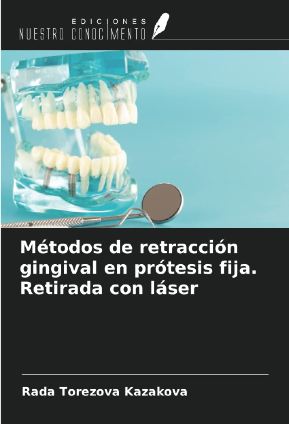 Metodos De Retraccion Gingival En Protesis Fija Retirada Con Laser ...