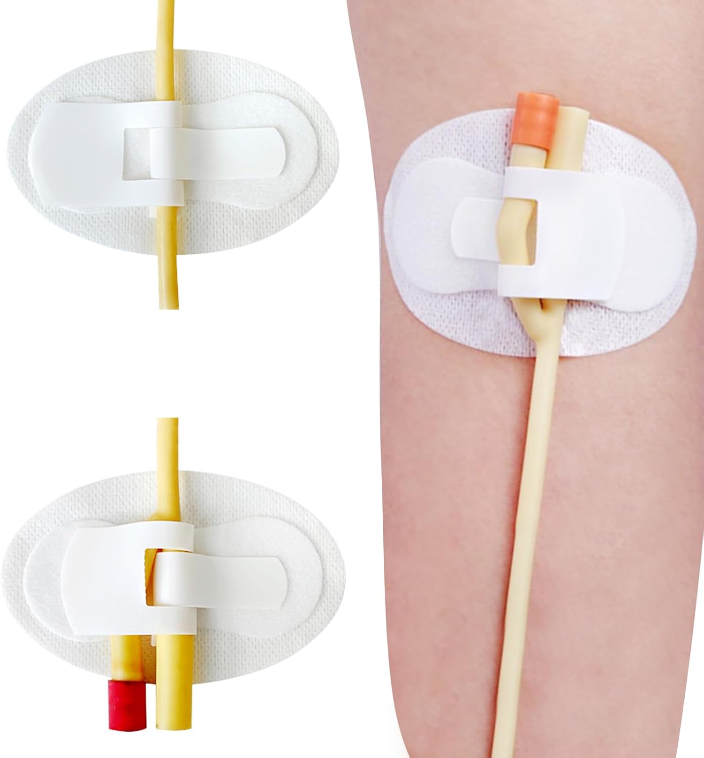Amazon.com: Foley Catheter Stabilization Device 50Pcs Urinary Leg Bag ...