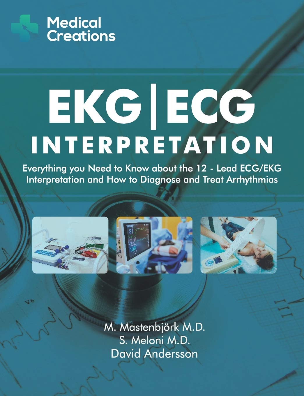 Buy EKG ECG Interpretation Everything You Need To Know About The 12