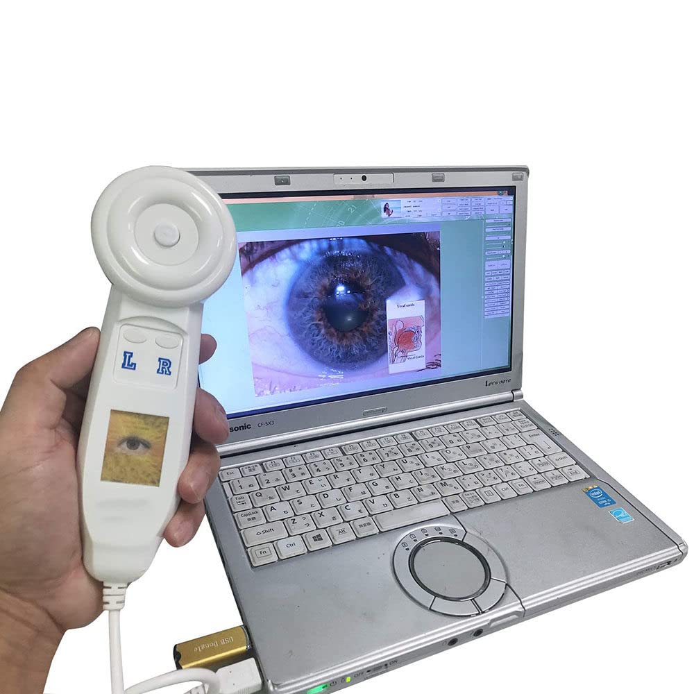 Buy Iris Analysis Camera, Usb Analyzer Irisology Camera, Computer Iris ...
