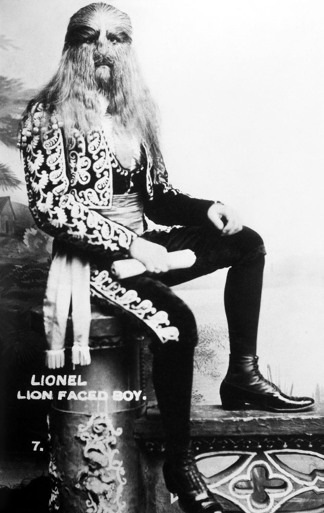 Lionel The Lion Faced Man