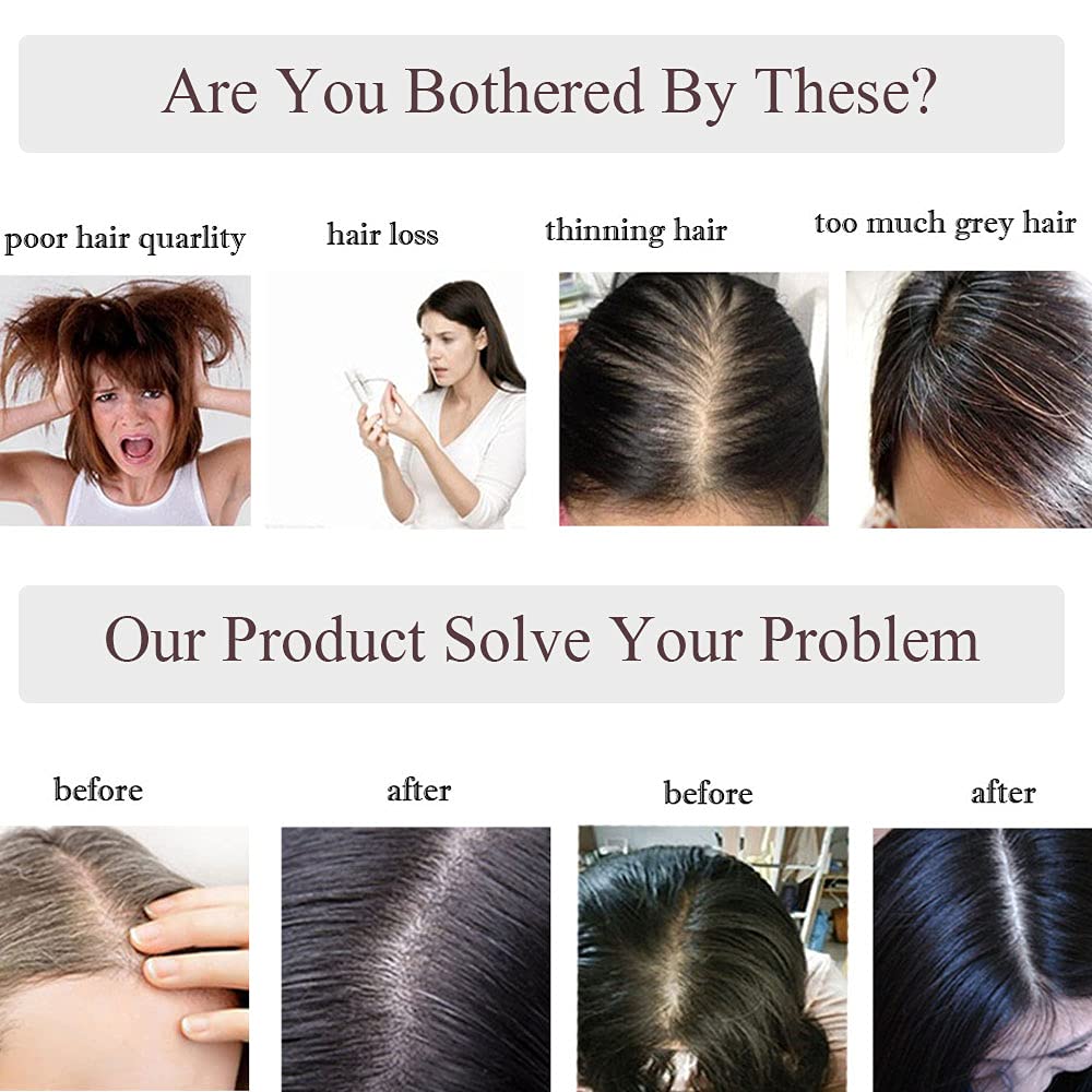 Normal Hair Part Width