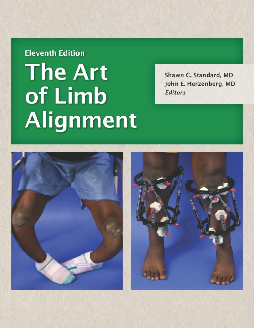The Art of Limb Alignment, Eleventh Edition: 9798429178394: Medicine ...