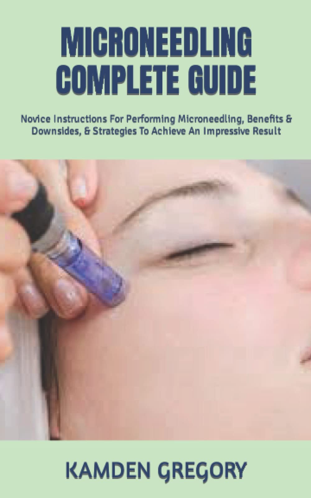 MICRONEEDLING COMPLETE GUIDE: Novice Instructions For Performing ...