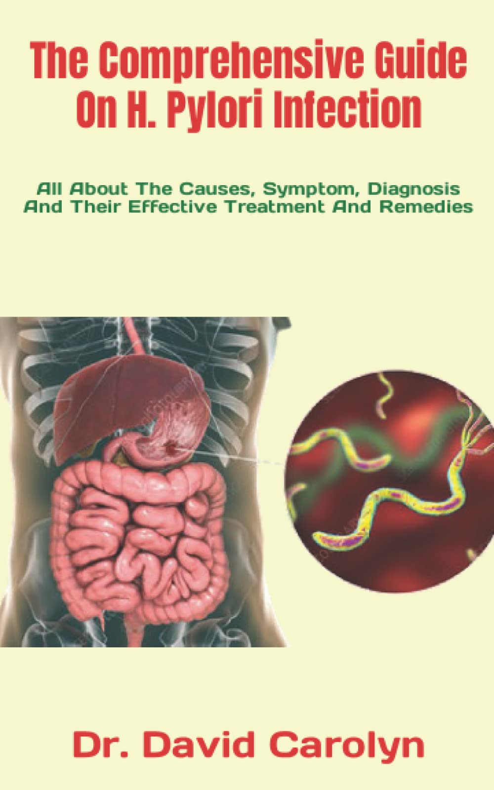 Buy The Comprehensive Guide On H. Pylori Infection: All About The ...