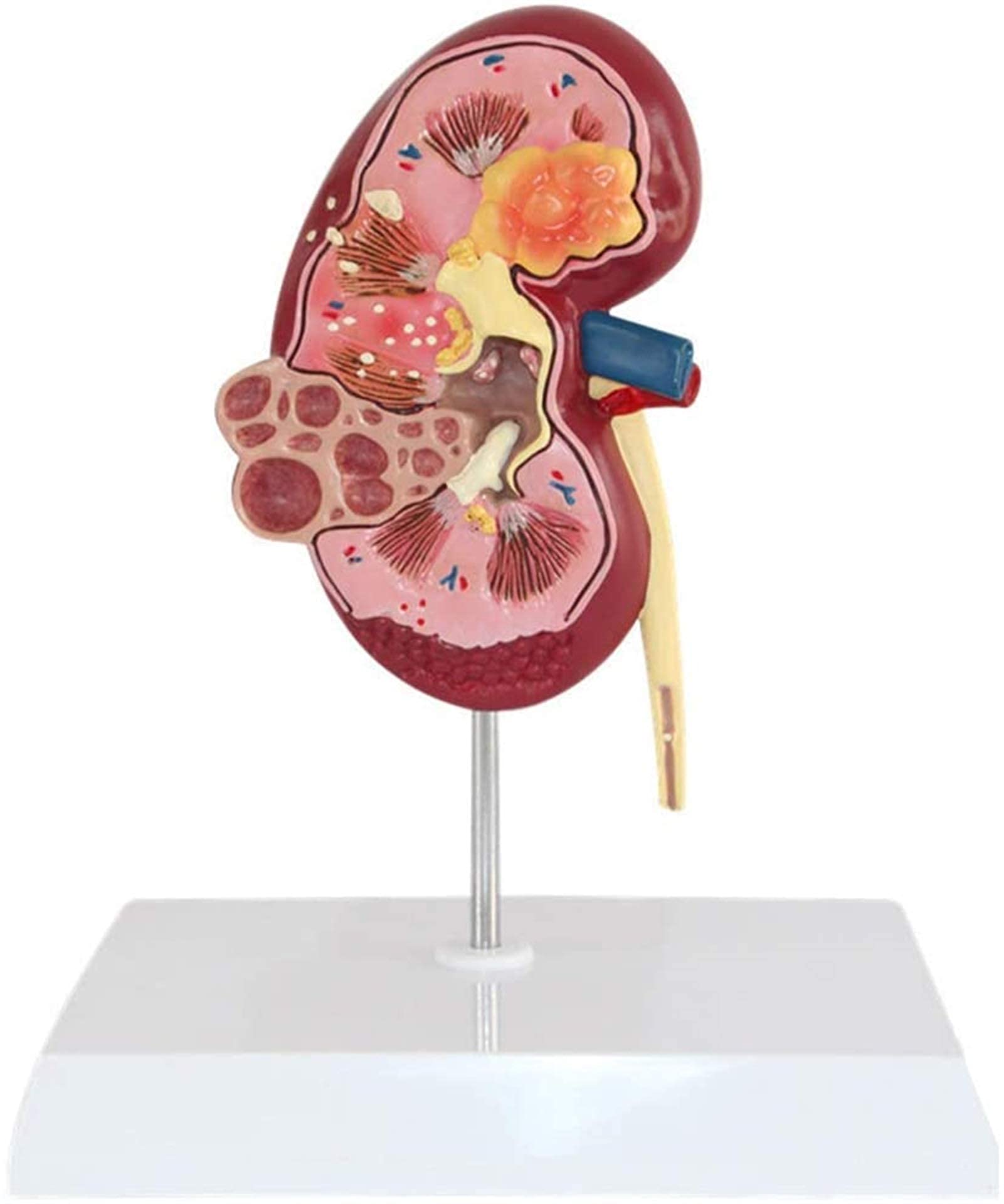 Buy WERYU Anatomy Model, Human Kidney Anatomical Model - Medical ...