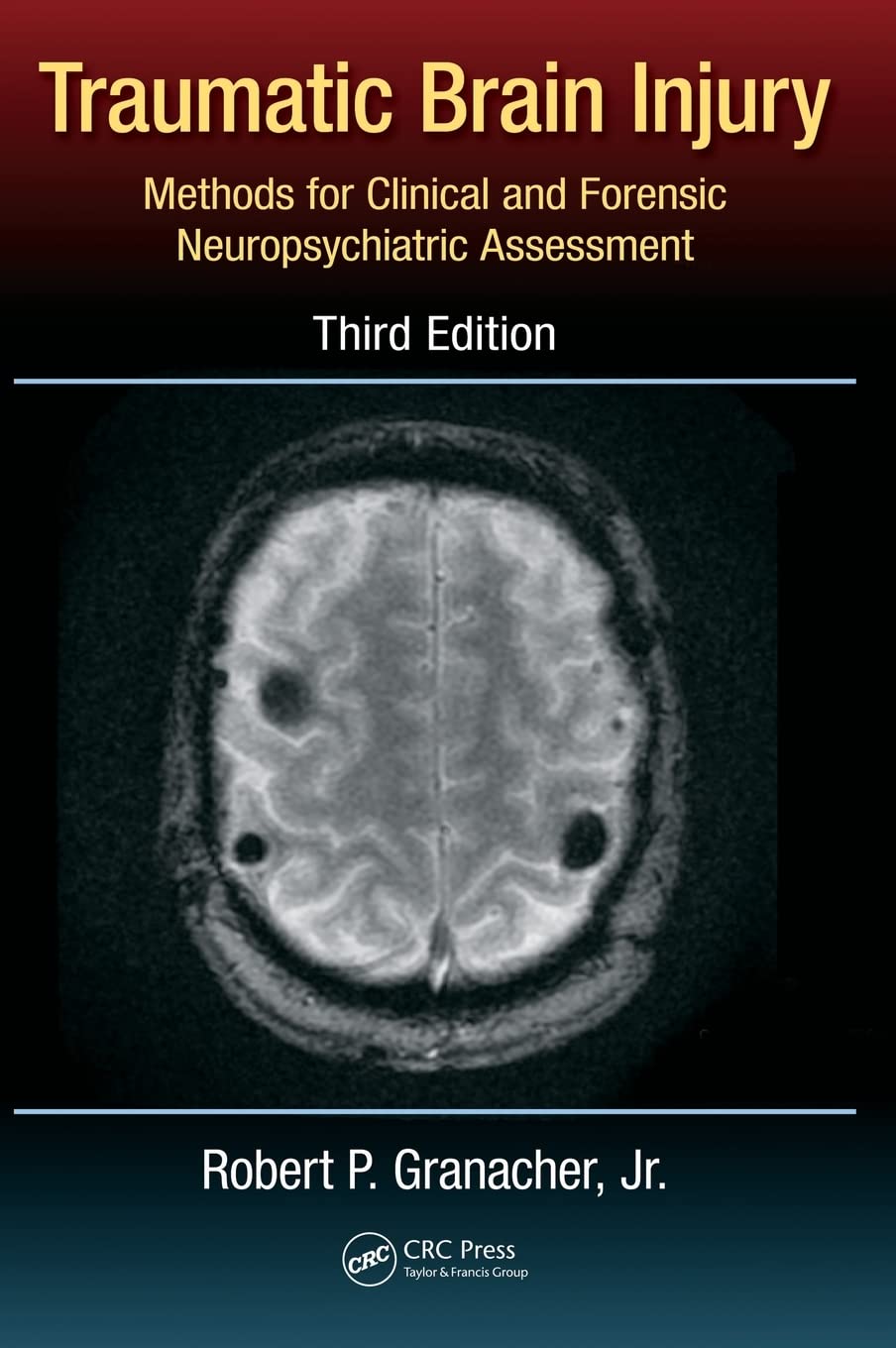 Traumatic Brain Injury: Methods for Clinical and Forensic ...