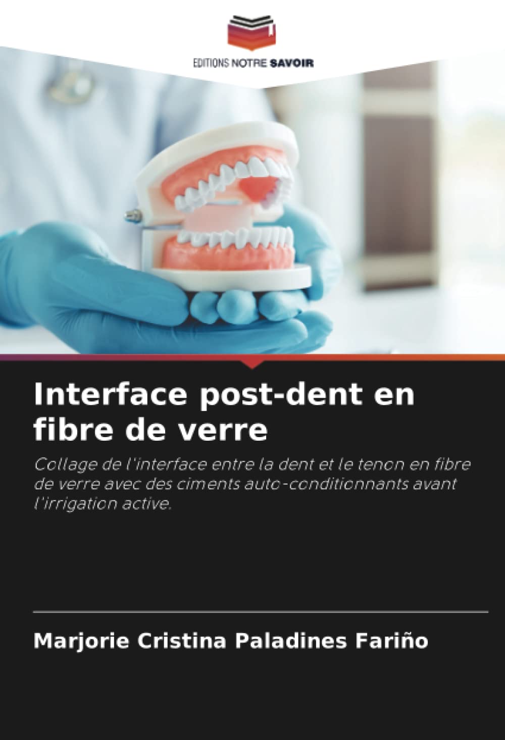 Buy Interface post-dent en fibre de verre: Collage de l'interface entre ...
