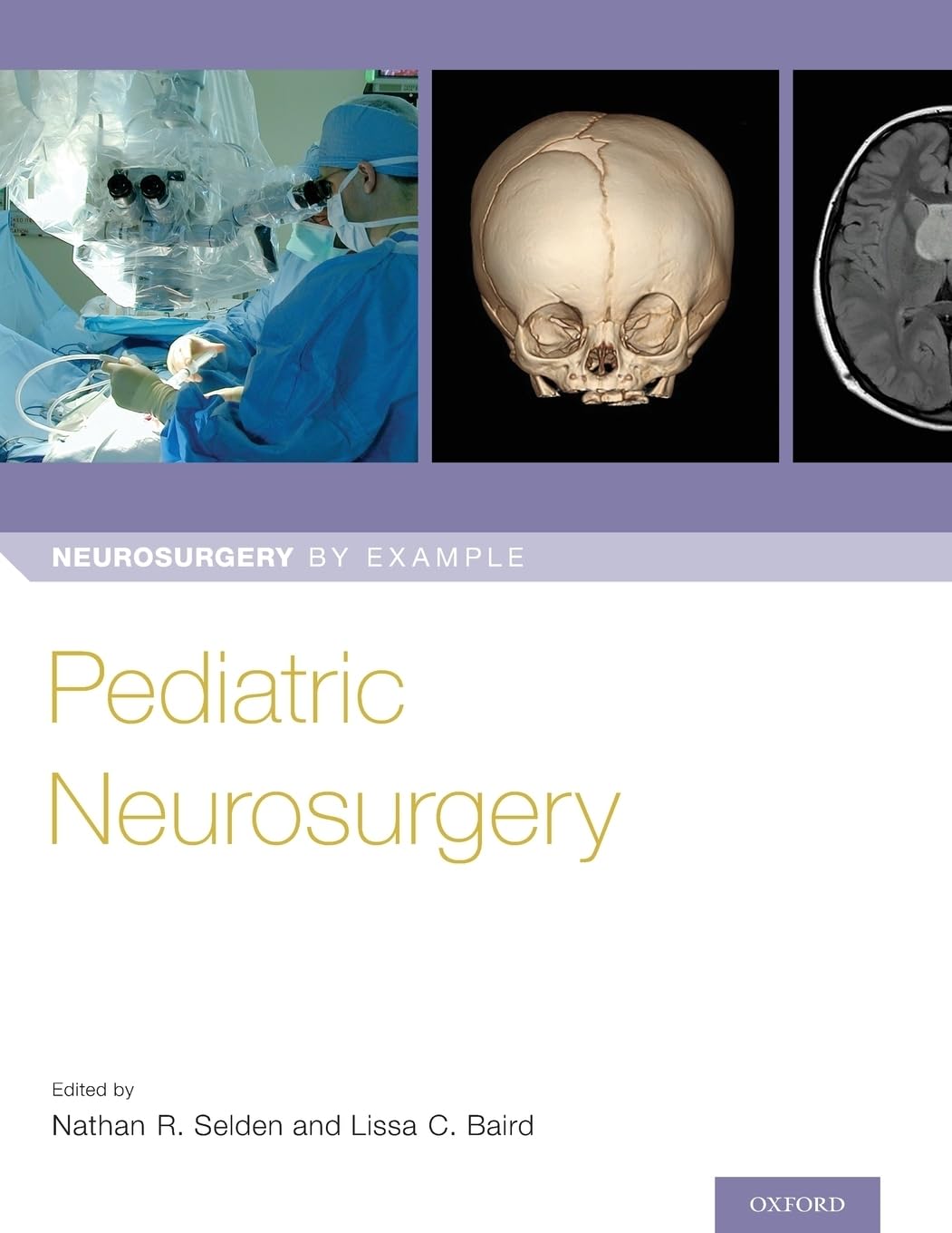 Pediatric Neurosurgery (Neurosurgery by Example): 9780190617073 ...