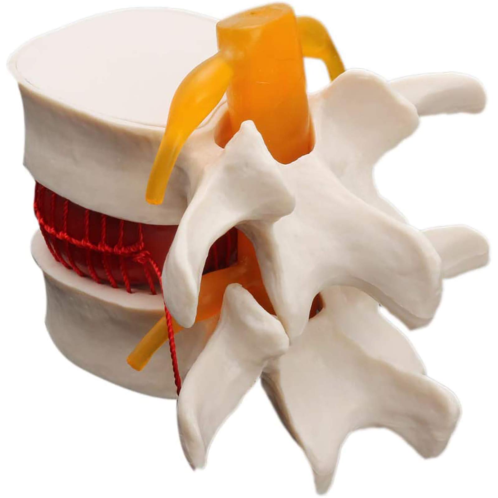 Buy Human Anatomy Skeleton Spine Lumbar Disc Herniation Teaching Model ...