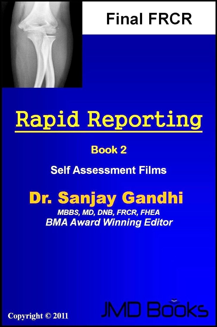 Rapid Reporting For FRCR 2B Vol.2 (Rapid Reporting Series) eBook ...