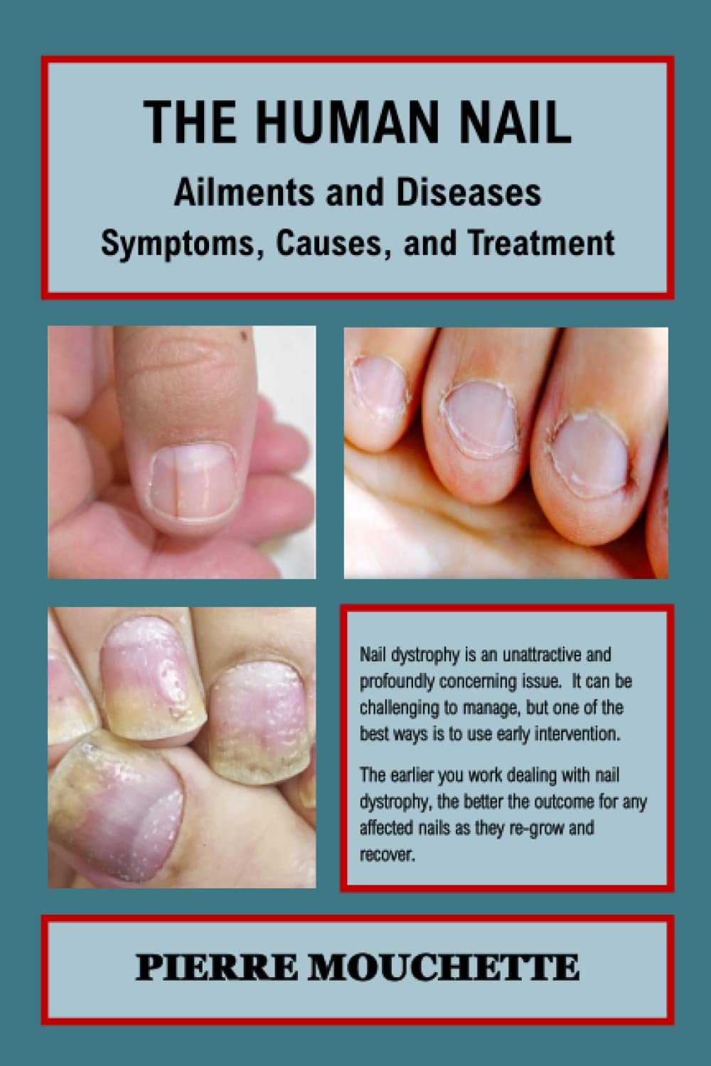 Diseases Of Fingernails And Signs