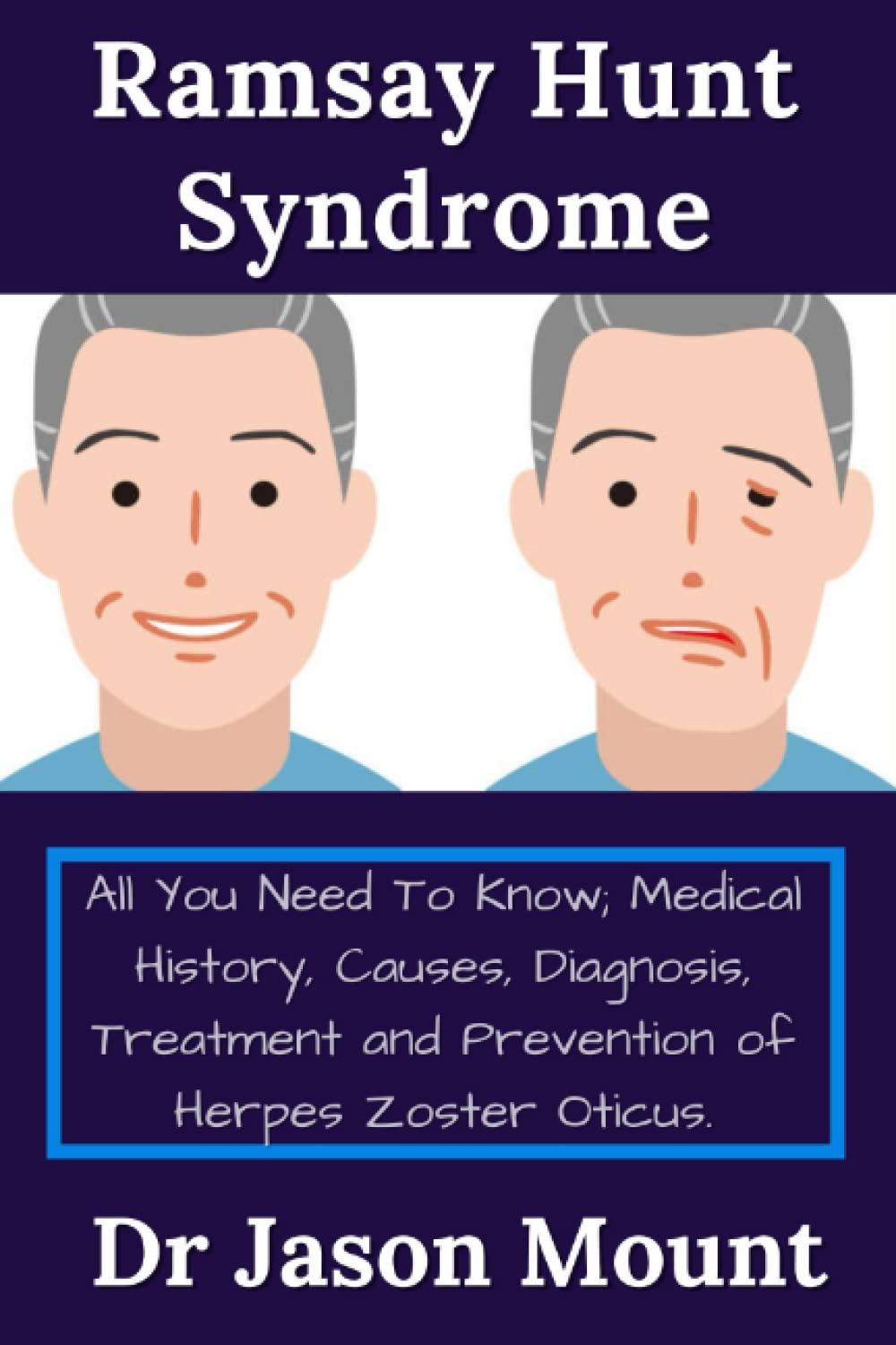 Buy Ramsay Hunt Syndrome: All You Need To Know; Medical History, Causes ...