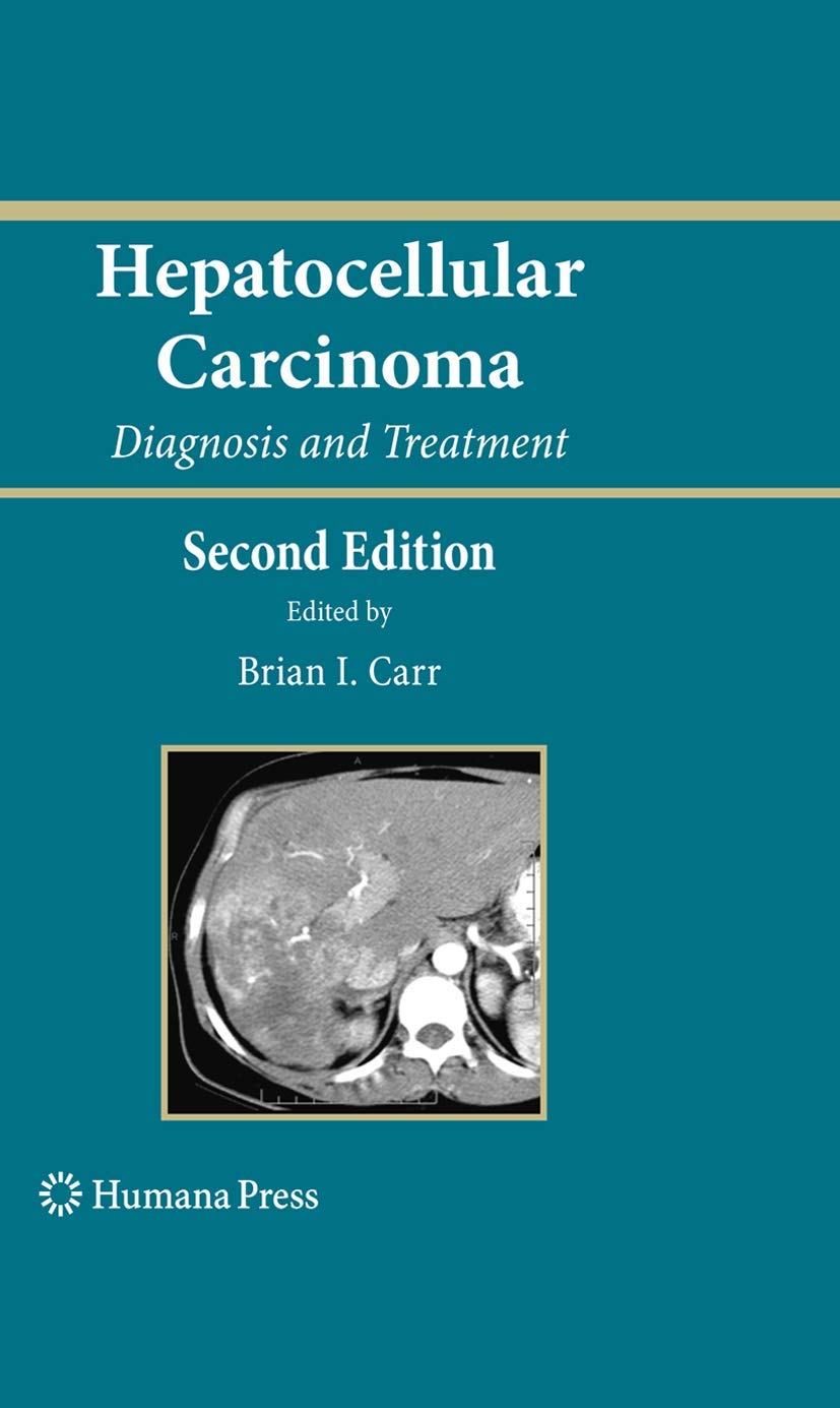 Hepatocellular Carcinoma: Diagnosis and Treatment (Current Clinical ...