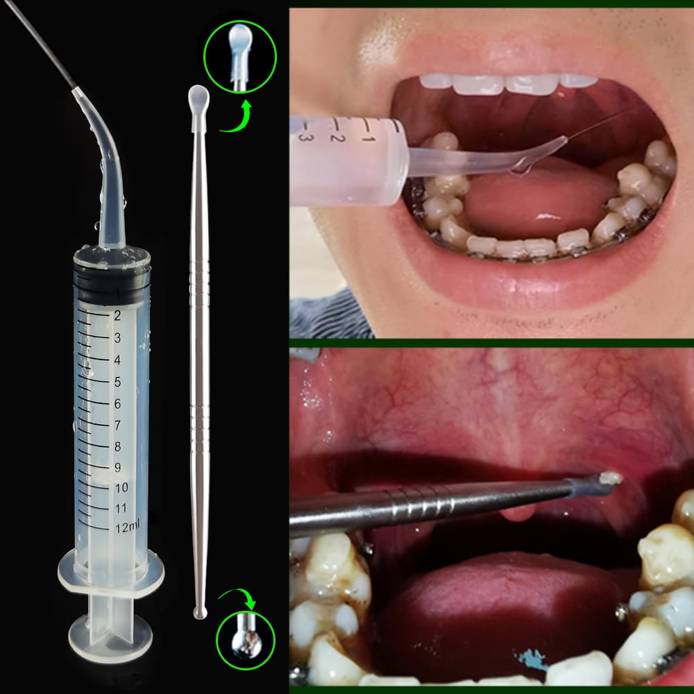 Snapklik.com : Airgoesin Tonsil Stone Remover, Stainless Steel Tonsil ...