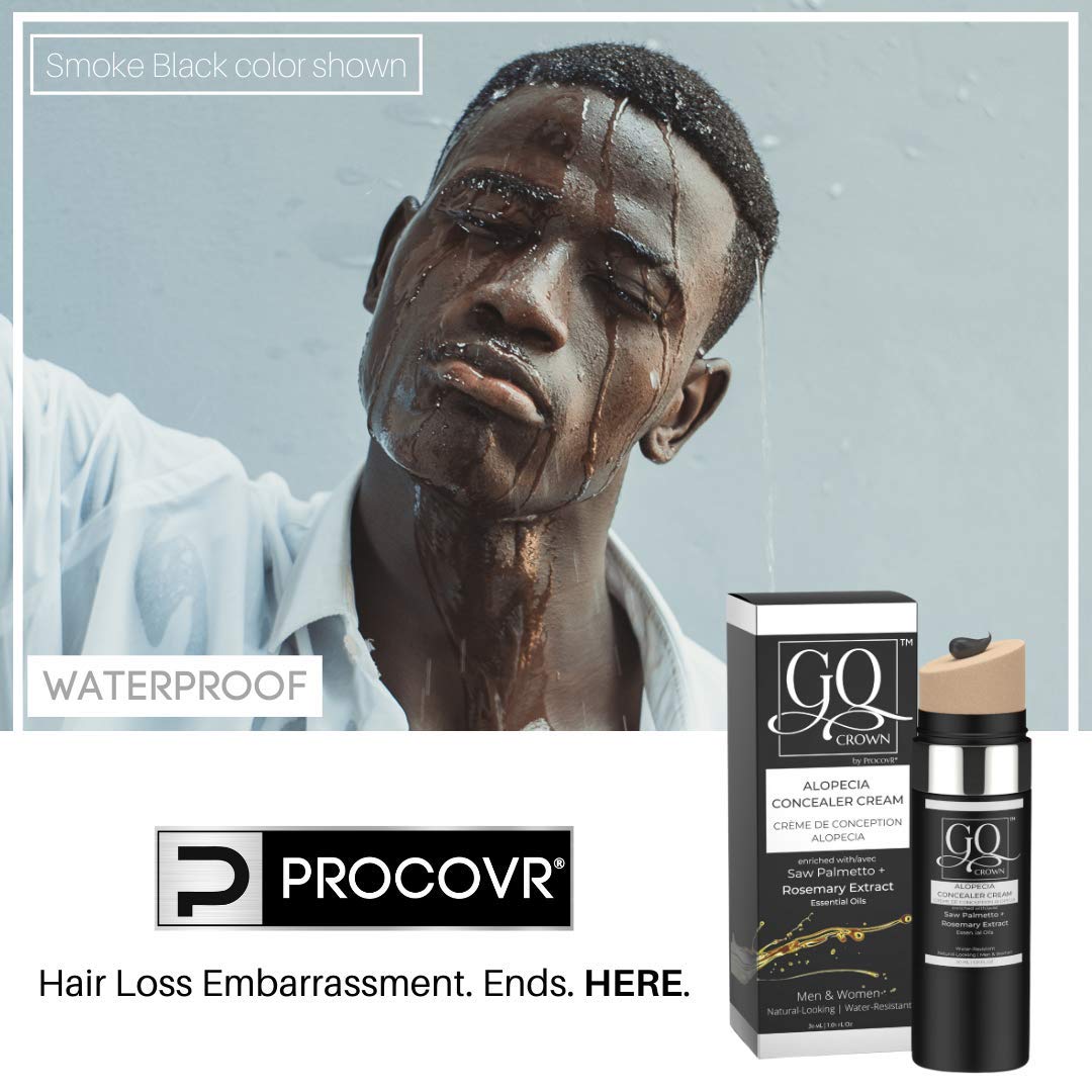 Hairline Hair Shade Scalp Concealer for Thinning & Balding with DHT ...
