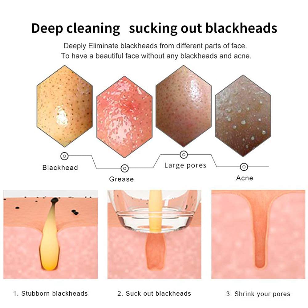 Blackhead Microscope