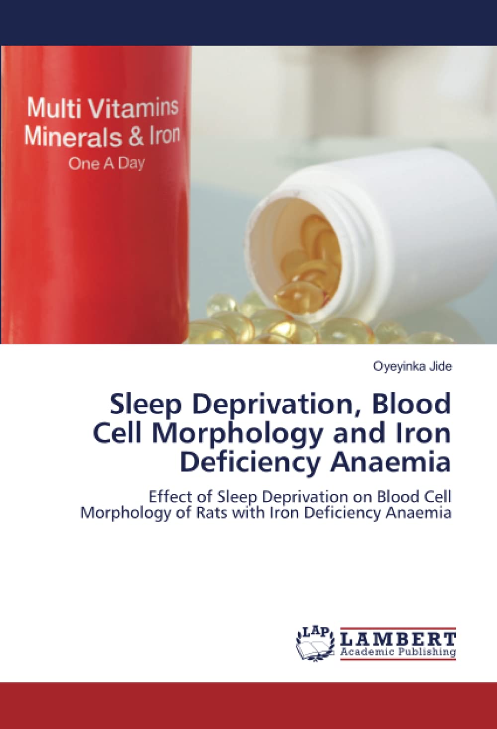 Sleep Deprivation Blood Cell Morphology And Iron Deficiency Anaemia ...