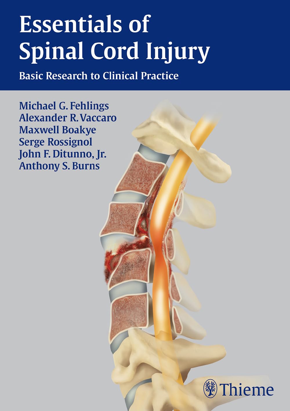 Essentials of Spinal Cord Injury: Basic Research to Clinical Practice ...
