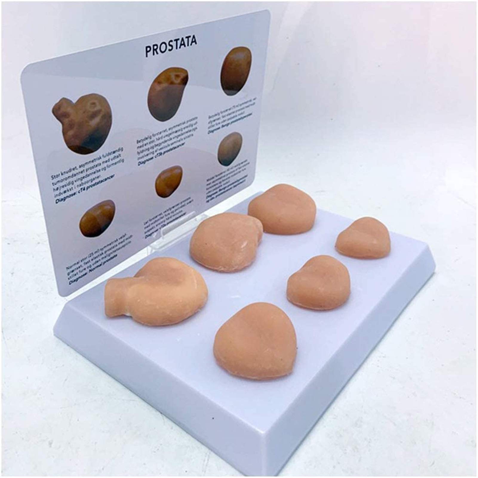 Buy Prostate Model Medical Teaching Model Prostate Lesion Template