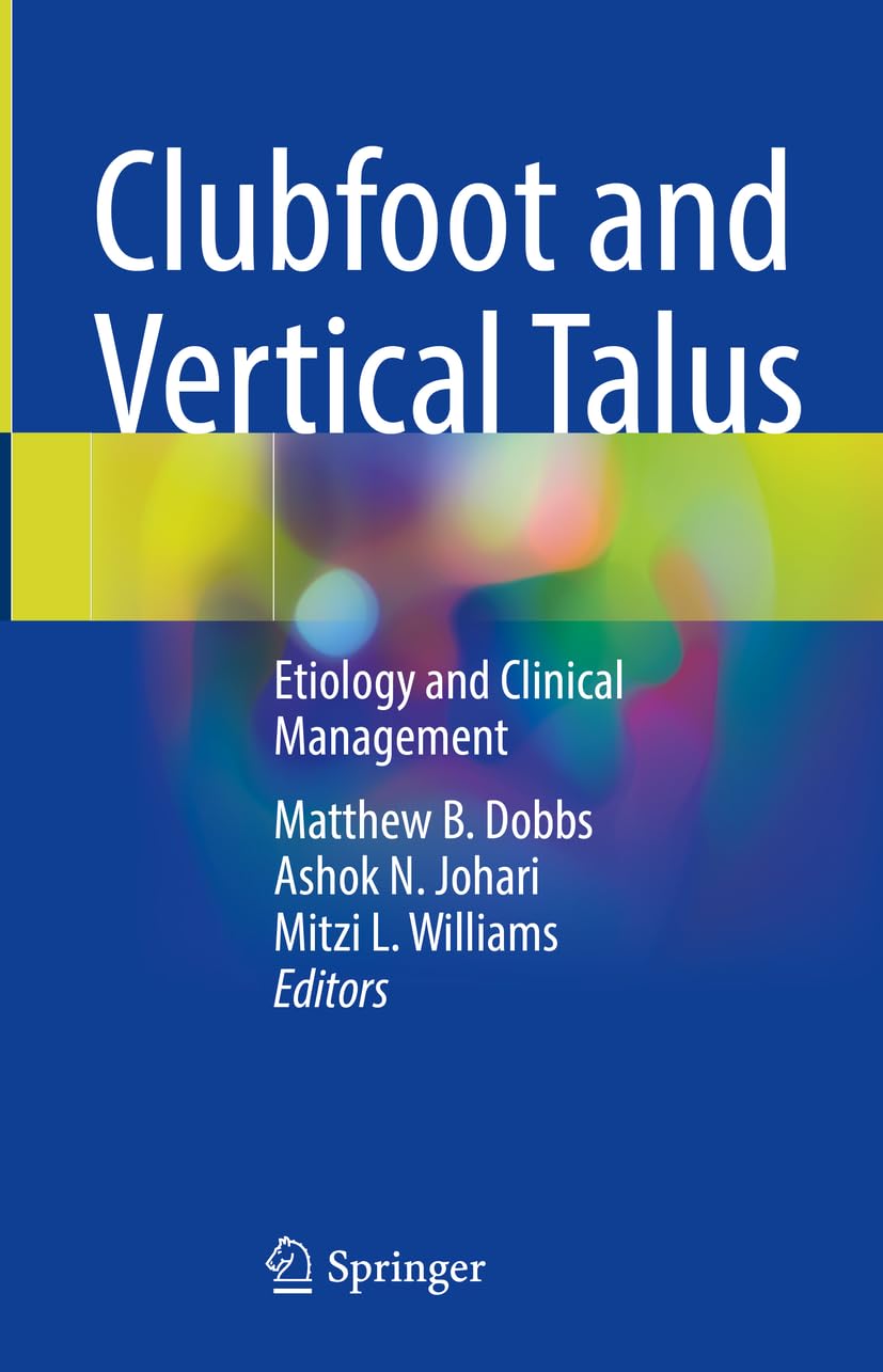 Clubfoot and Vertical Talus: Etiology and Clinical Management ...