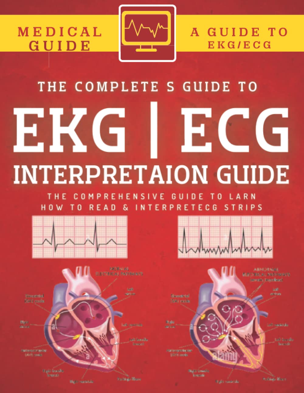 Buy EKG | ECG Interpretation Guide: The Comprehensive Guide To Learn ...