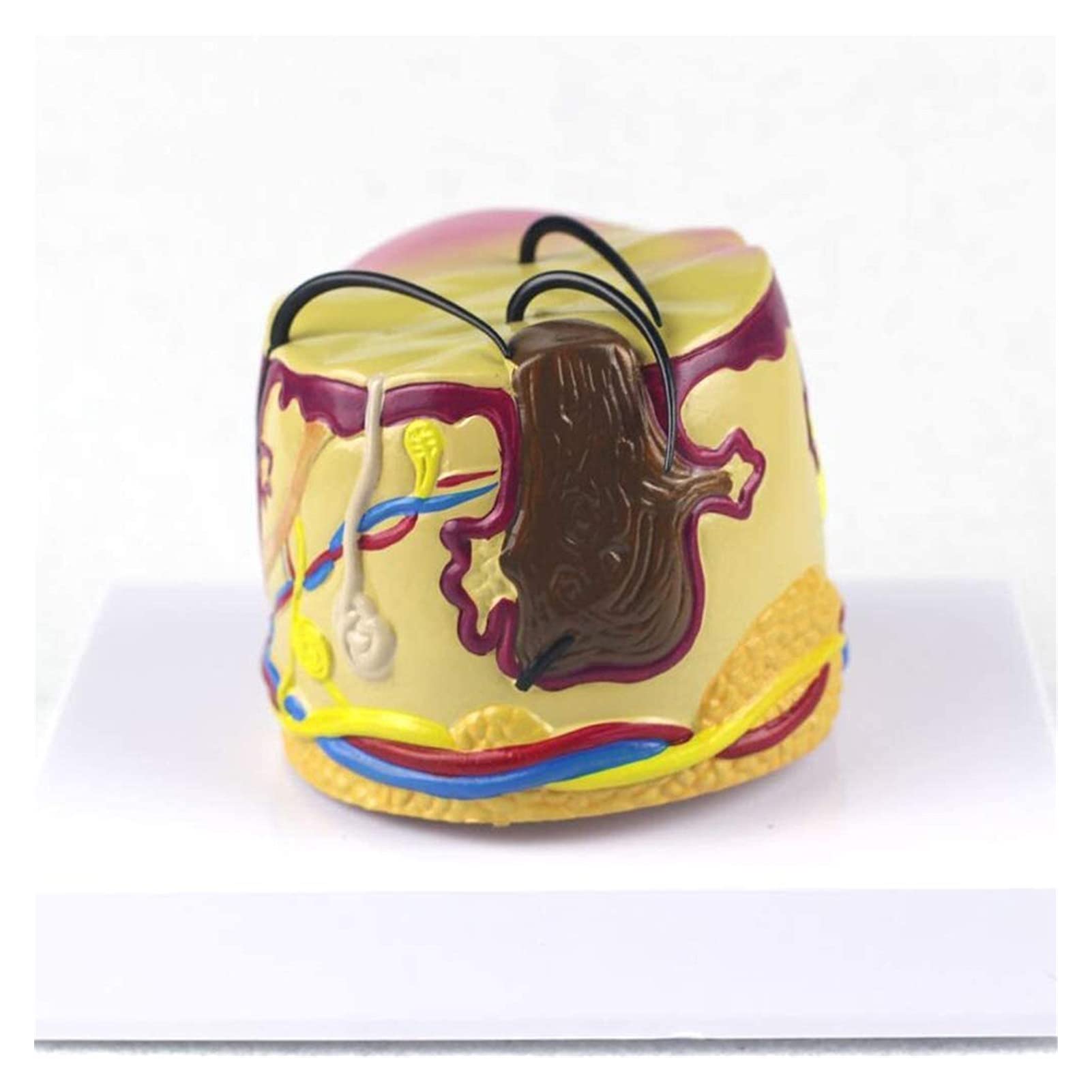 Buy Study Model Skin Model Acne pustule Blackhead Hair Follicle Hair ...