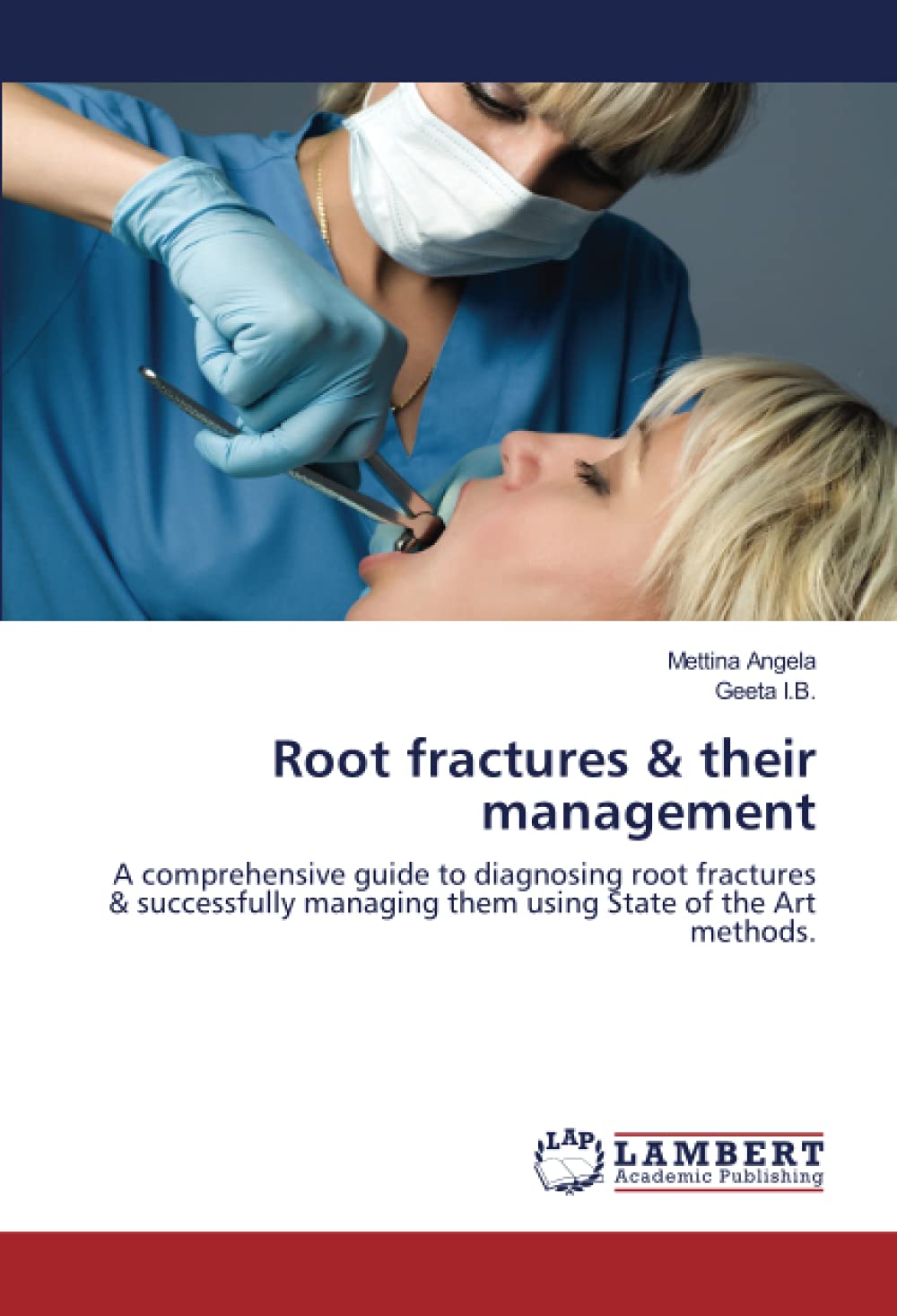 Buy Root fractures & their management: A comprehensive guide to ...