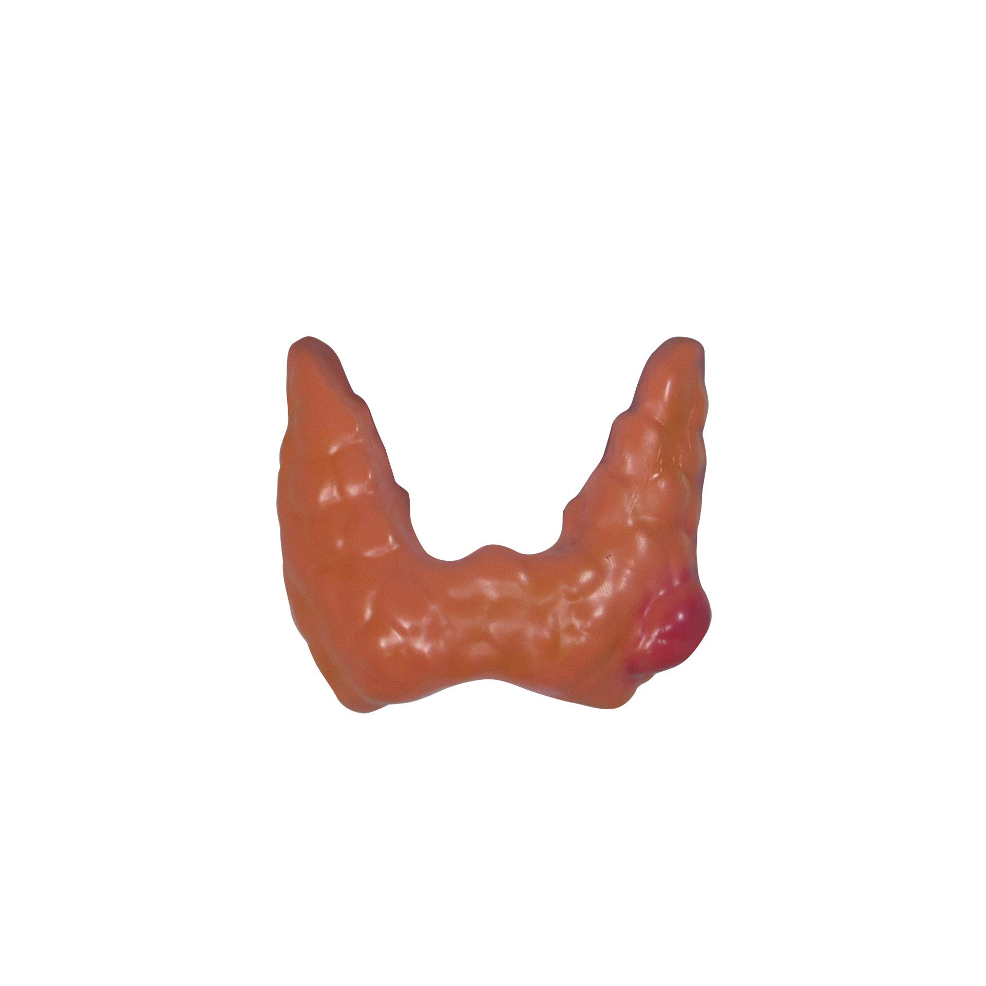 Thyroid Model Set | Human Body Anatomy Replica of Thyroid w/Diseases ...