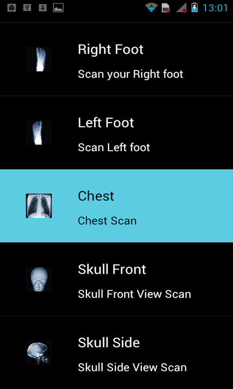 Real X-Ray Scan - App on the Amazon Appstore