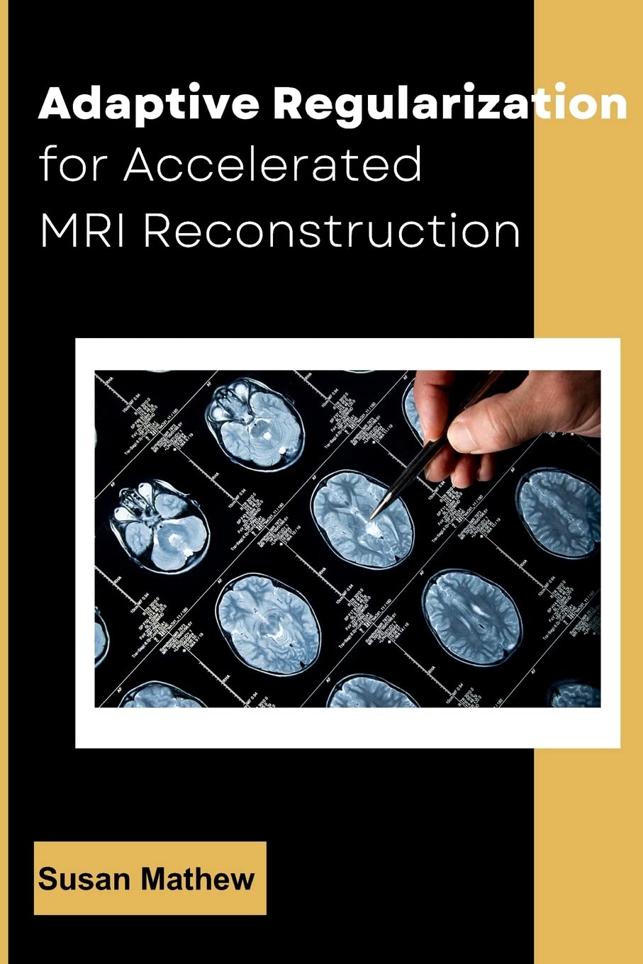 Adaptive Regularization For Accelerated Mri Reconstruction Susan