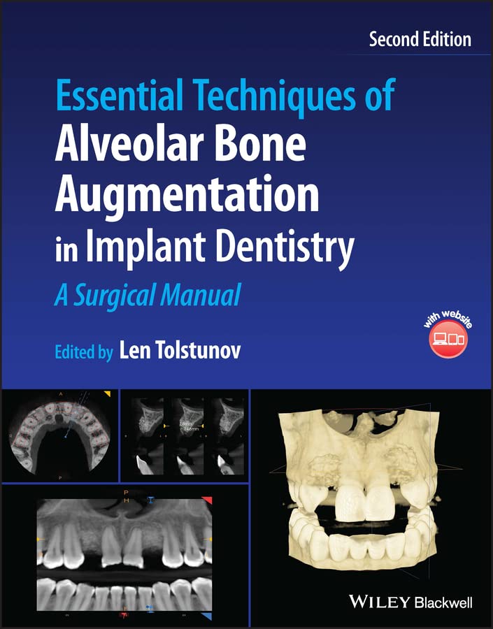 Amazon.com: Essential Techniques of Alveolar Bone Augmentation in ...