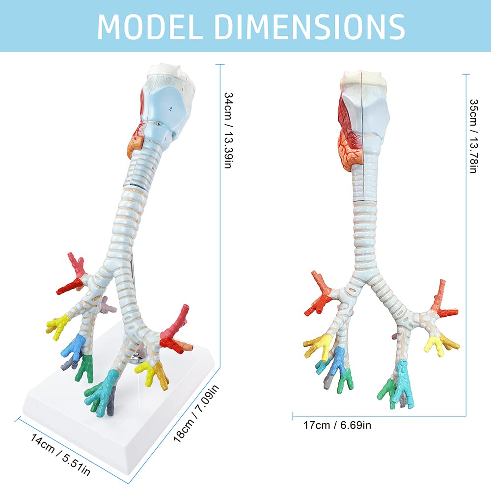 Bronchial Tree Model Labeled