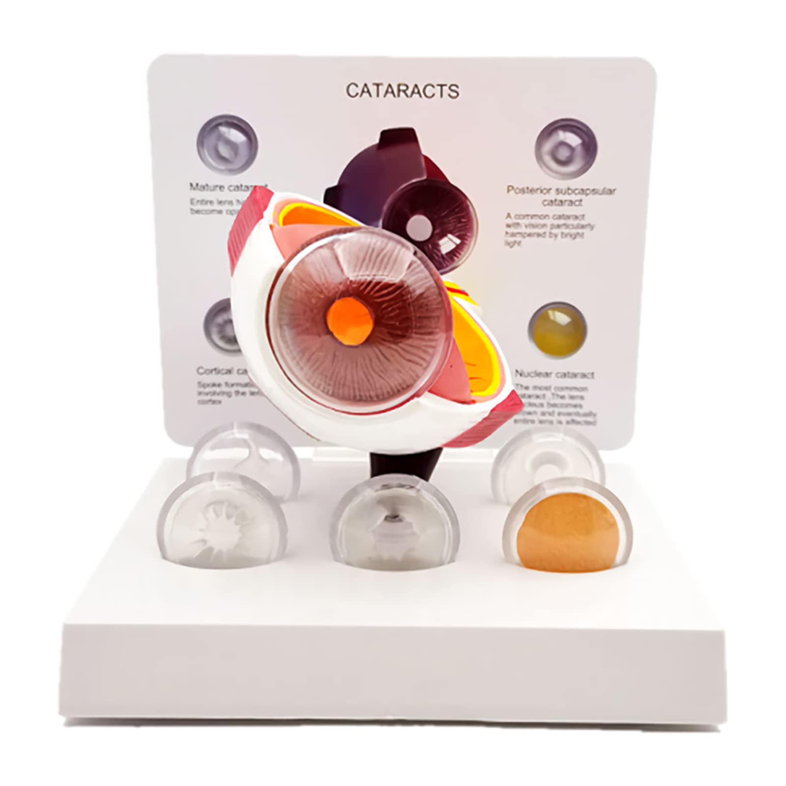 Wsxka Half Eye Anatomical Model Cataract Eye Model Disease Model ...