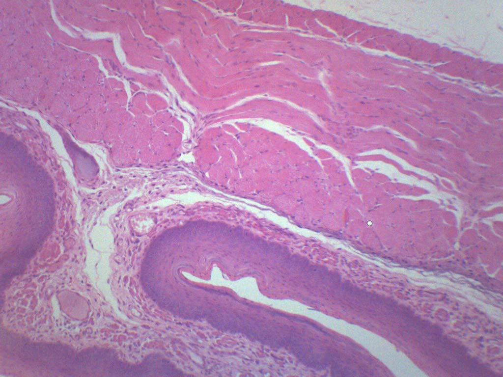 Labeled Esophagus Slide