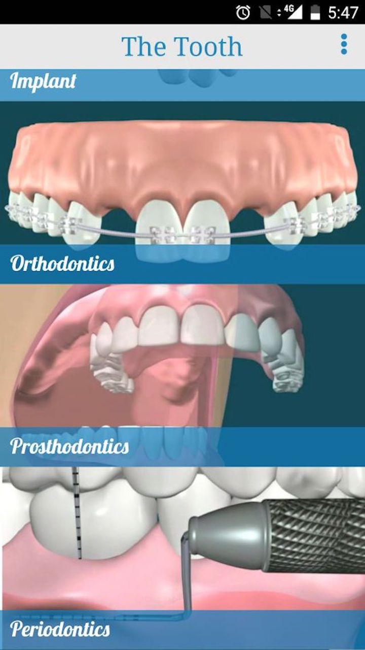 The Tooth Dental Consultation software - App on Amazon Appstore