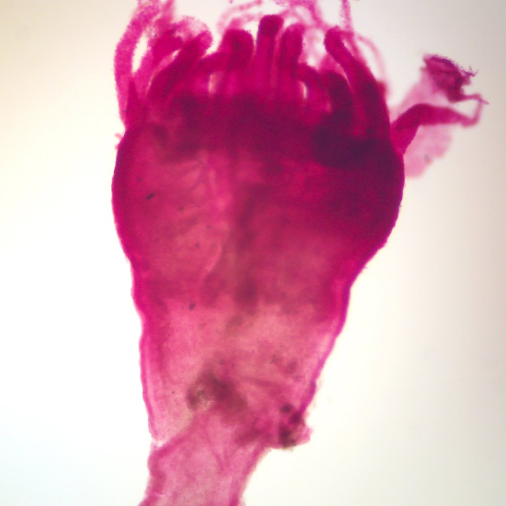 Aurelia Ephyra Slide