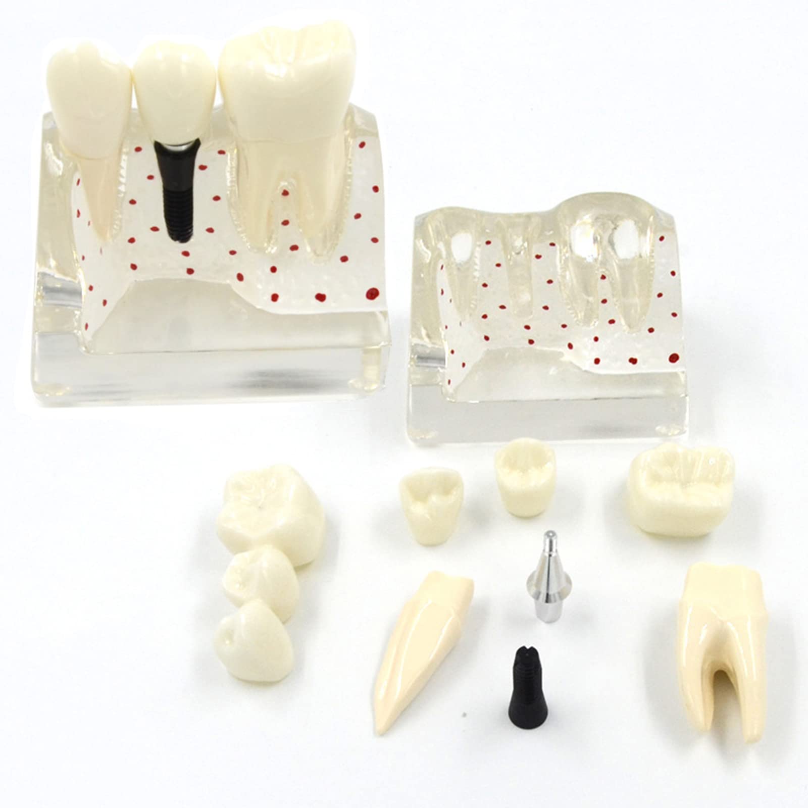 Buy NaoSIn-Ni Transparent Dental Im Model, Dental Analysis Crown Bridge ...