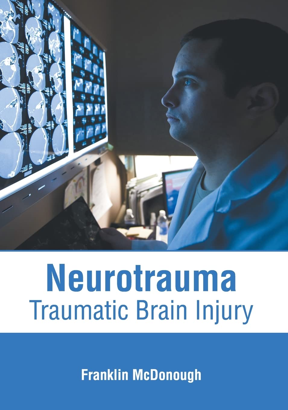 Neurotrauma: Traumatic Brain Injury: 9781639273218: Medicine & Health ...