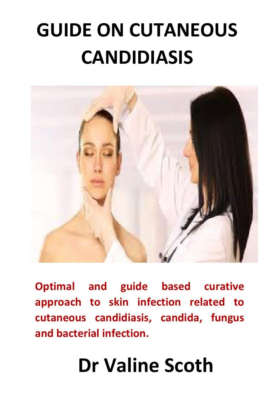 Buy Guide on Cutaneous Candidiasis: Optimal and guide based curative ...