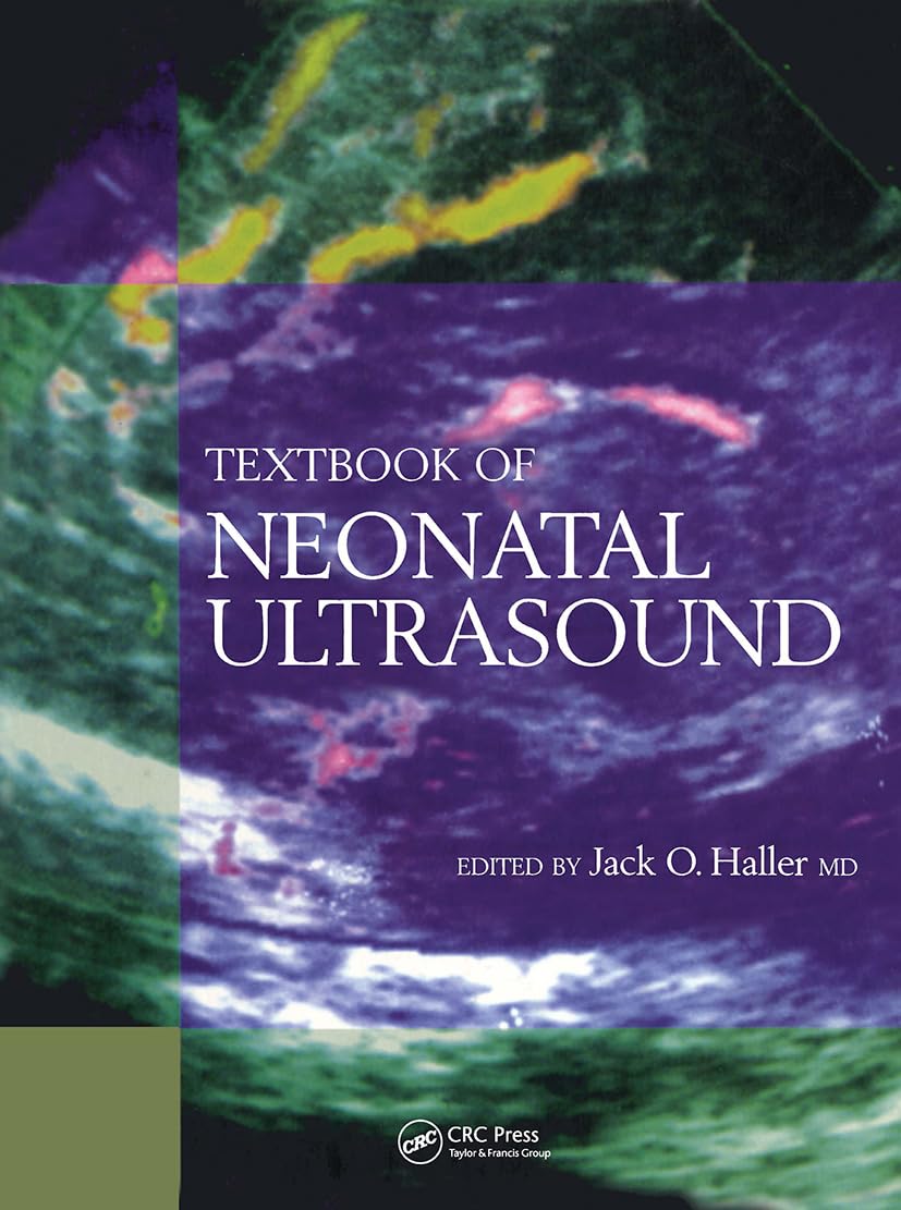 Textbook of Neonatal Ultrasound: 9781850709022: Medicine & Health ...