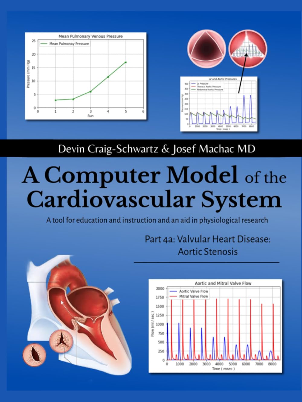 A computer model of the cardiovascular system: 9798873127405: Medicine ...