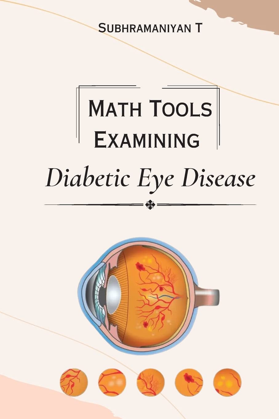 Buy Math Tools Examining Diabetic Eye Disease Book Online at Low Prices ...