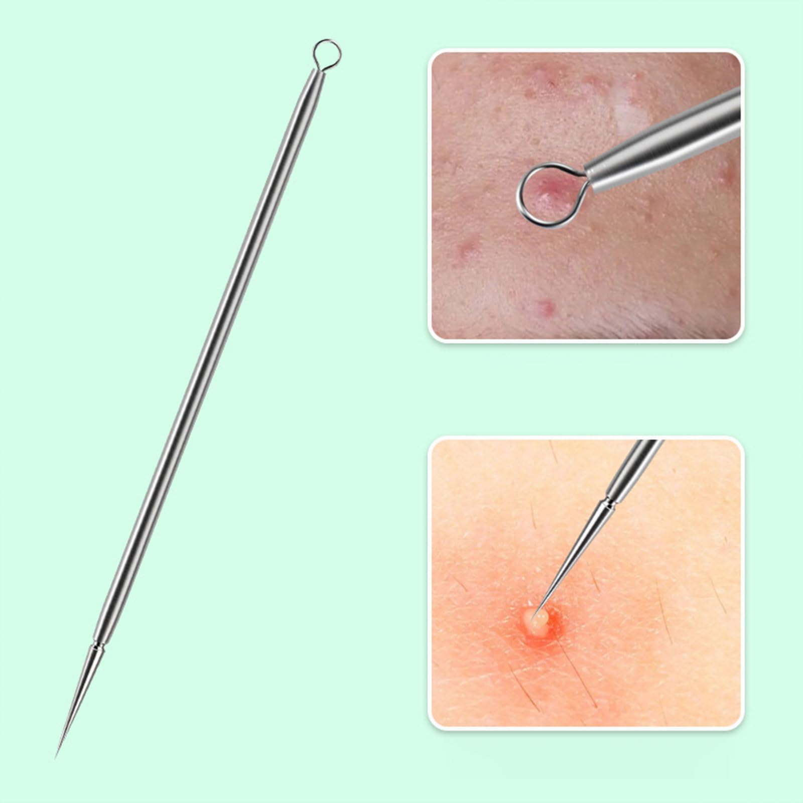 Titanium Lancet Needle Acne Blackhead Remover Pimple Extractor Popper Tool,spot Popper,spot ...