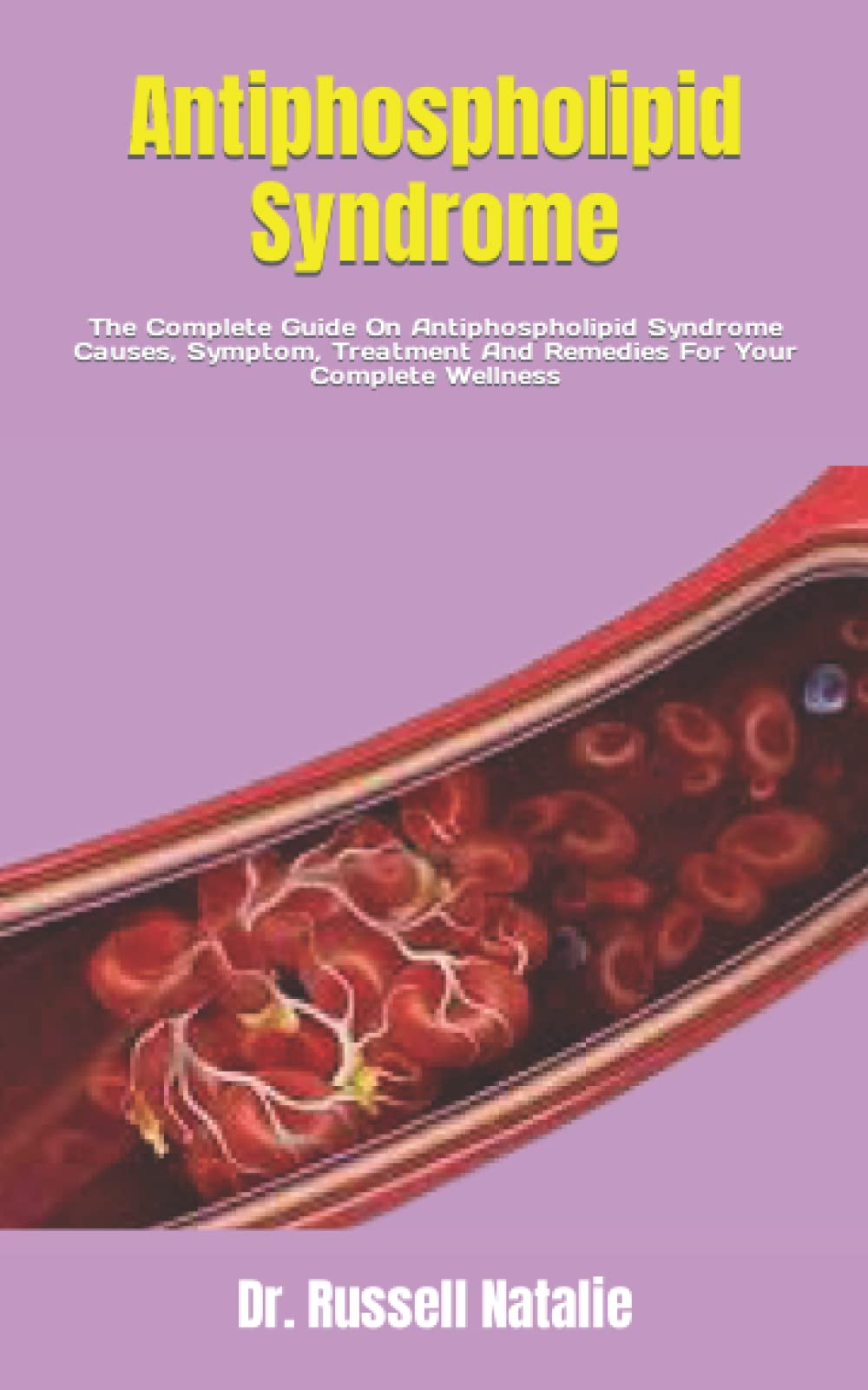 Buy Antiphospholipid Syndrome: The Complete Guide On Antiphospholipid ...