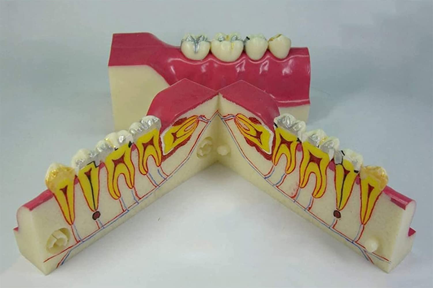 Buy Educational Model Decomposition Model of Right Lower ior Teeth, 1 ...