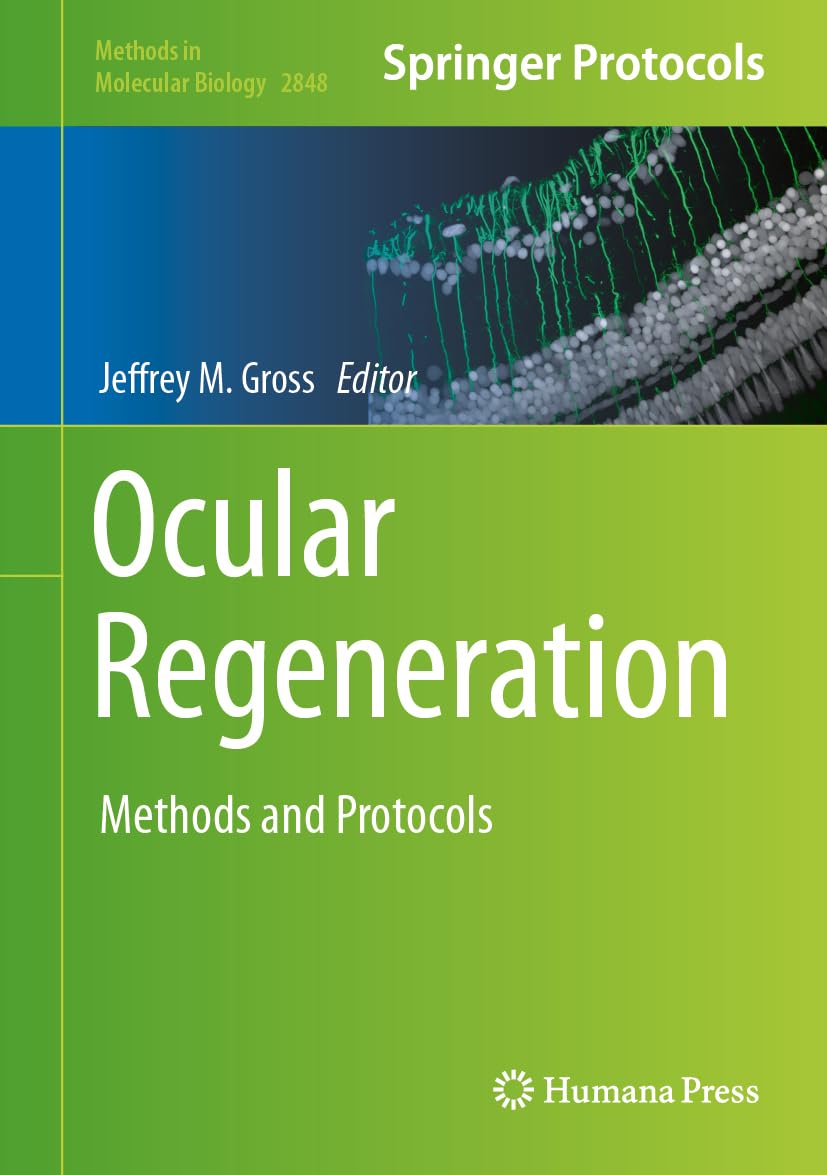 Ocular Regeneration: Methods and Protocols (Methods in Molecular Biology, 2848): 9781071640869 ...